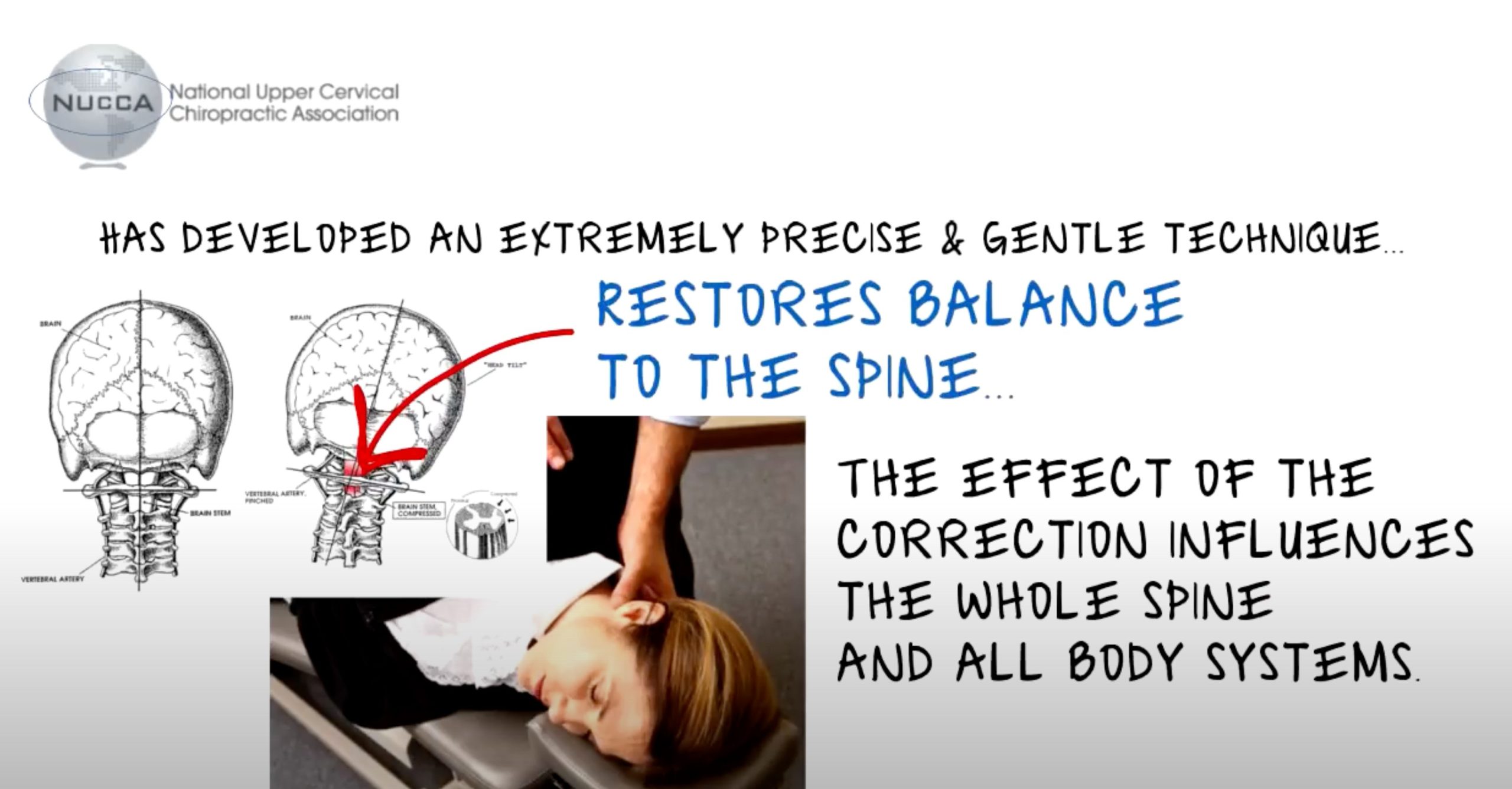 Learn About NUCCA Chiropractic Care - Progressive Chiropractic - Dr ...